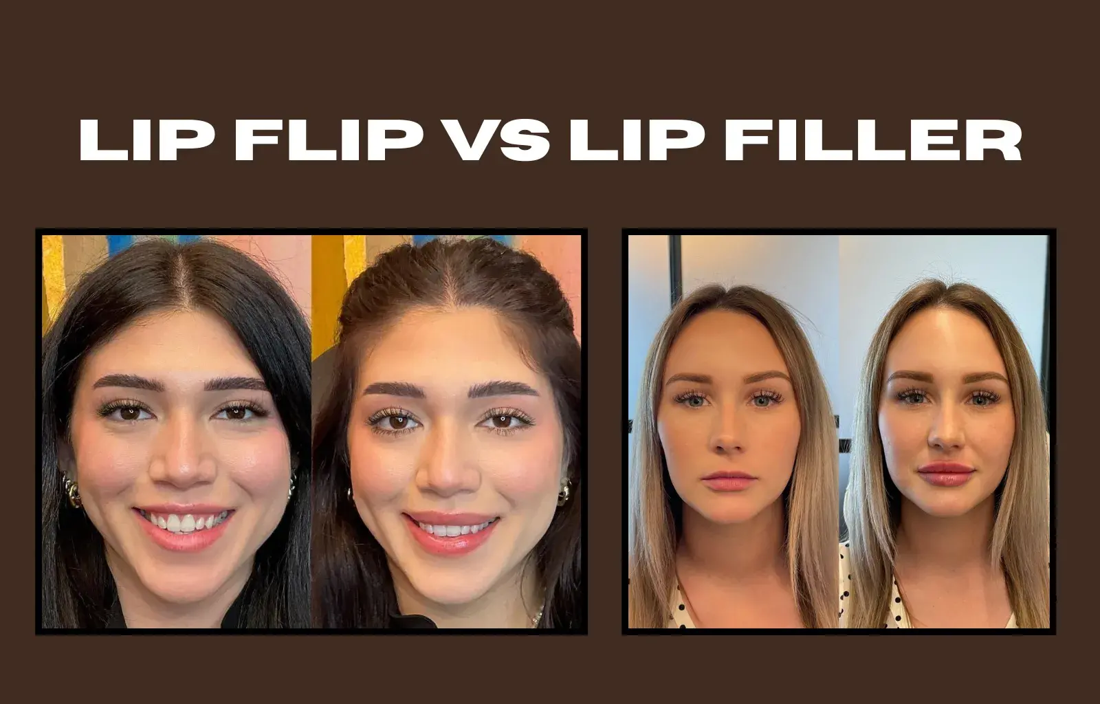 Lip Flip vs Lip Filler: Why Choosing the Wrong One Leads to Regret